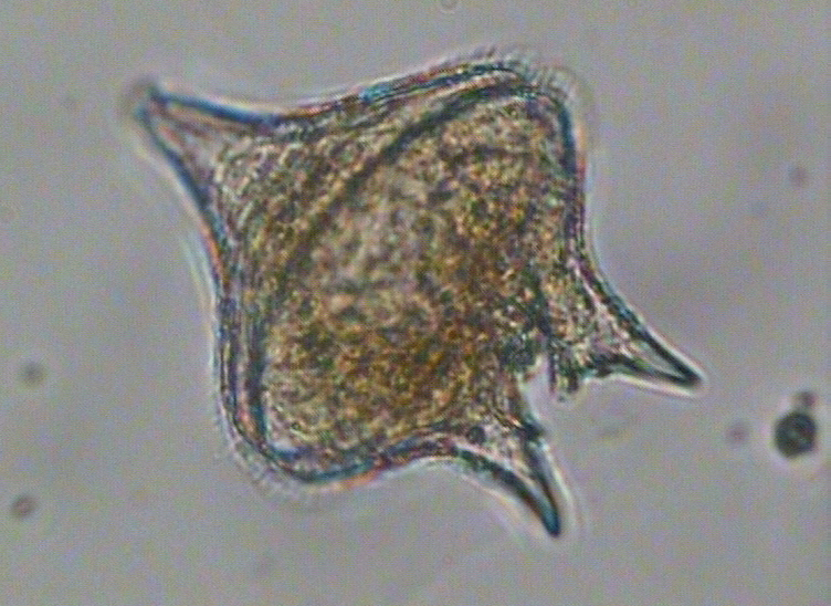 protoperidinium sp